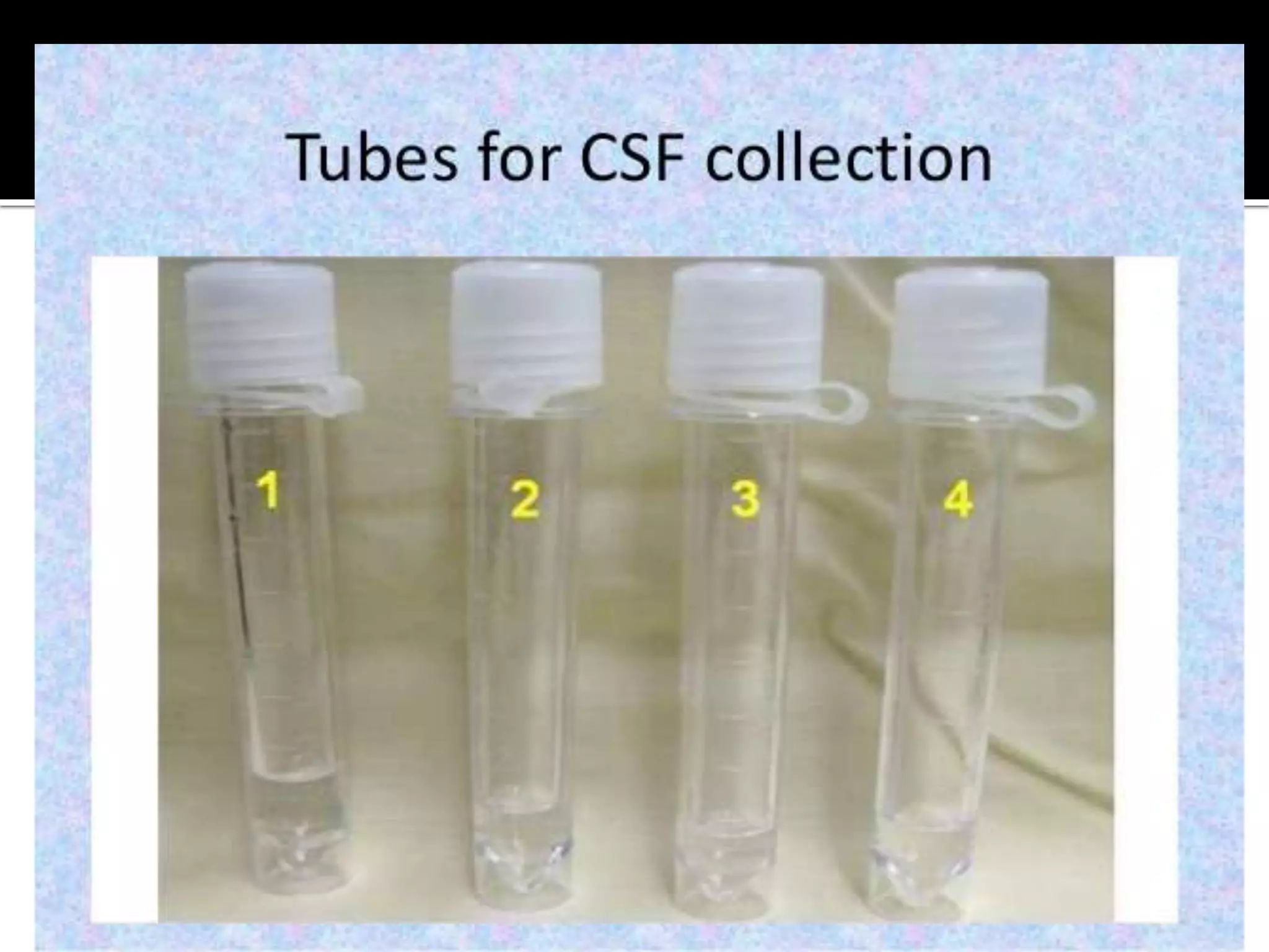 Collection, transport and processing of clinical specimens: CSF | PPTX