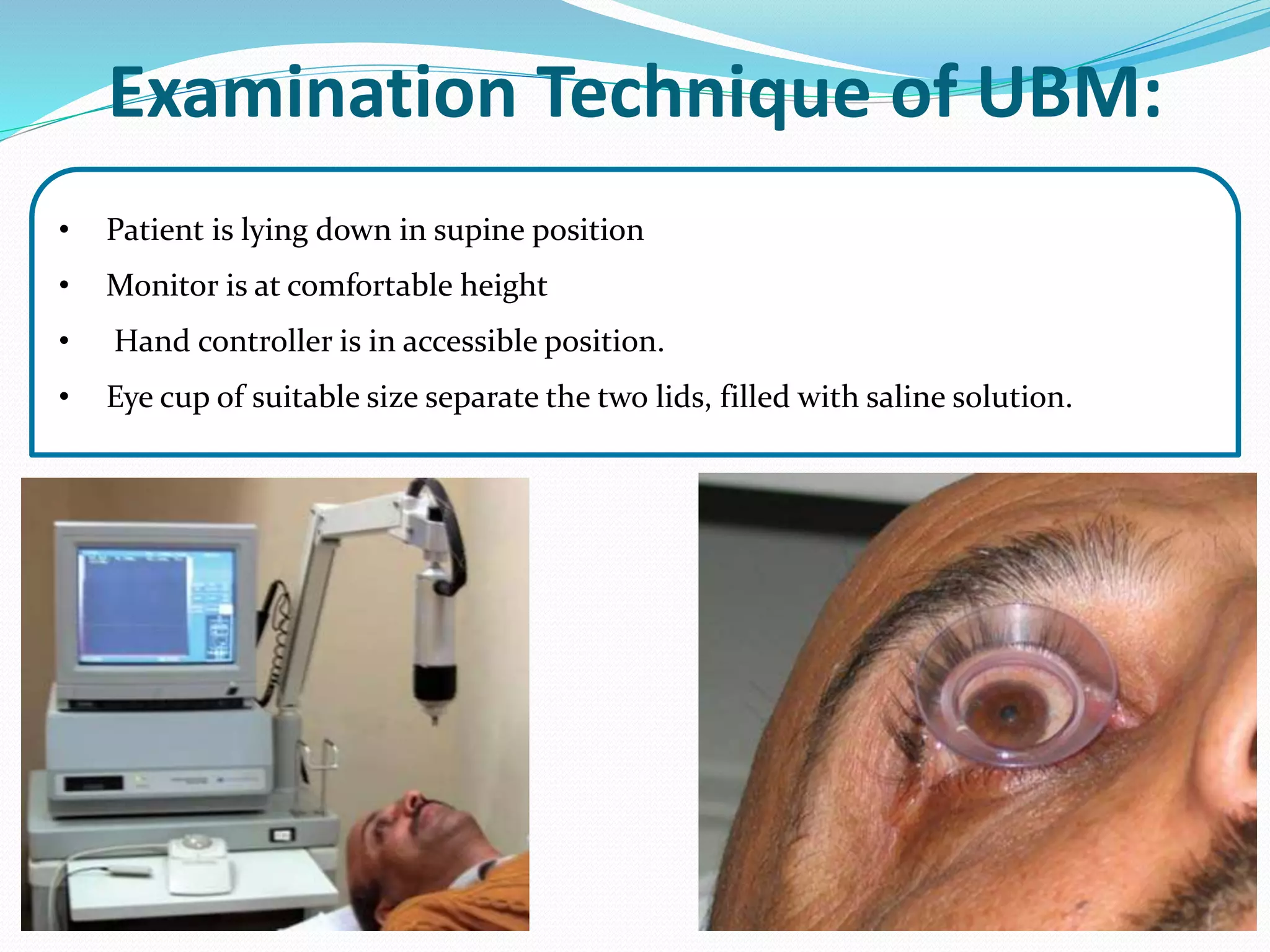 Ultrasonic evaluation of eyes with blunt trauma | PPTX