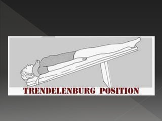 Modified Trendelenburg Position For Shock