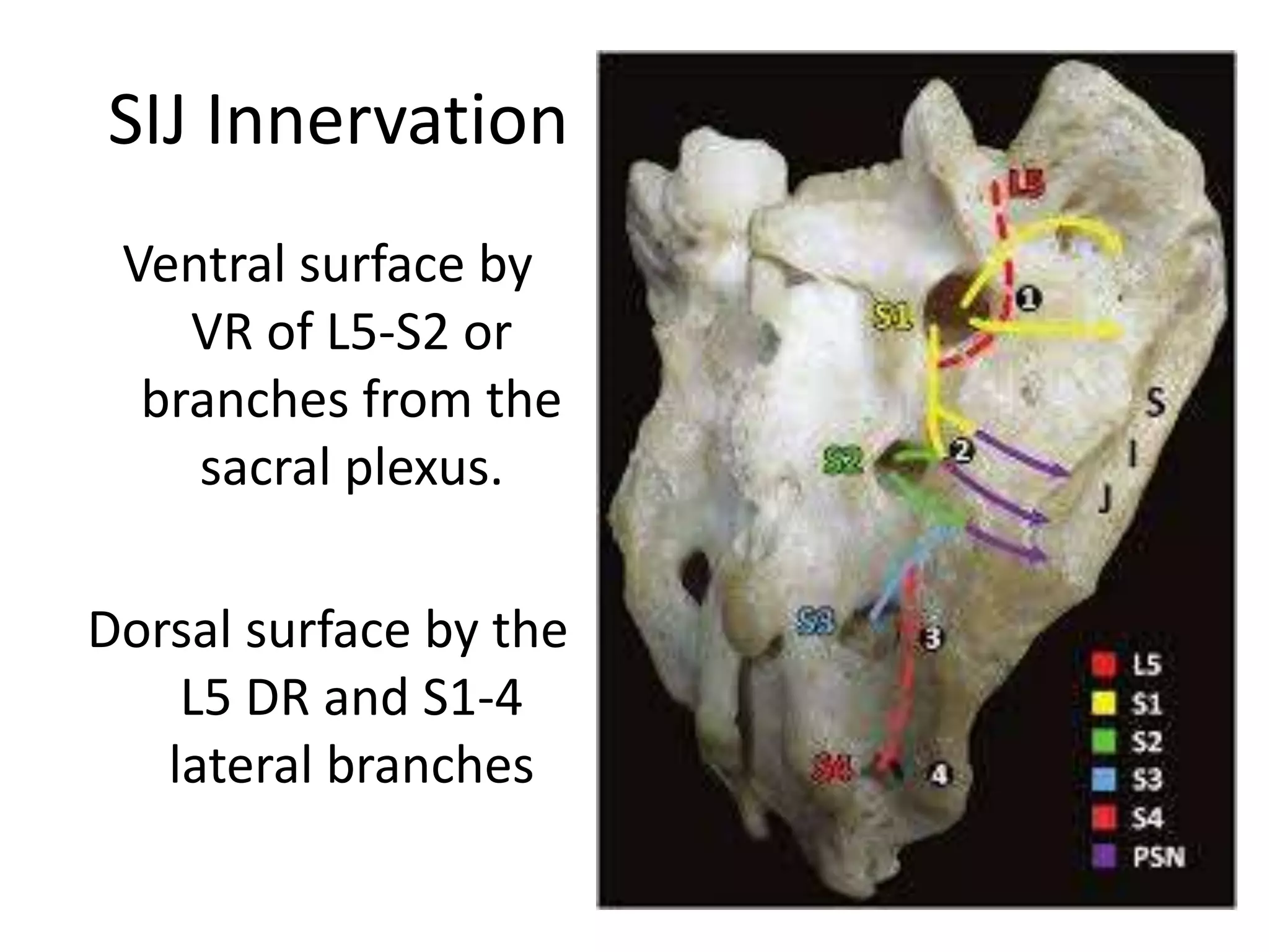 Sacroiliac Joint RF Denervation | PPTX