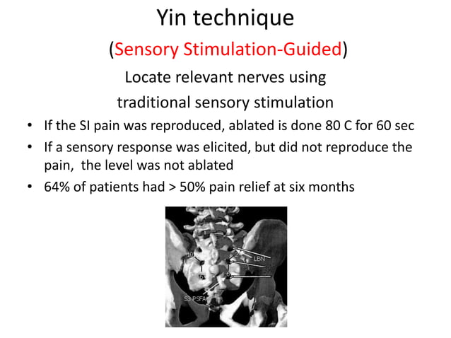 Sacroiliac Joint RF Denervation | PPTX | Bone and Joint Conditions ...