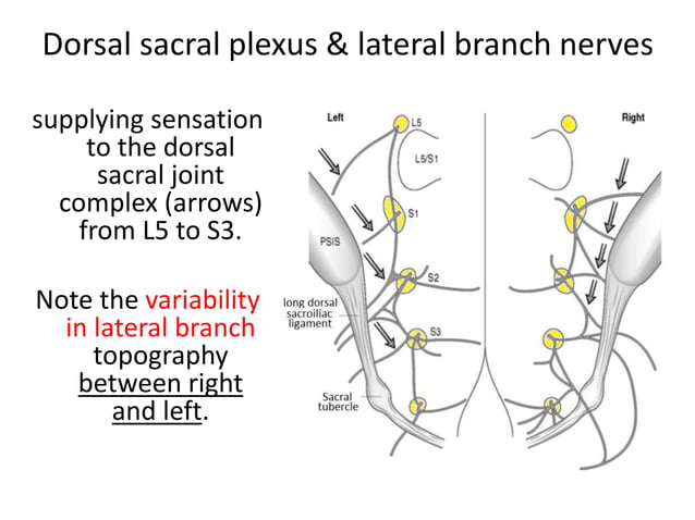 Sacroiliac Joint RF Denervation | PPTX | Bone and Joint Conditions ...