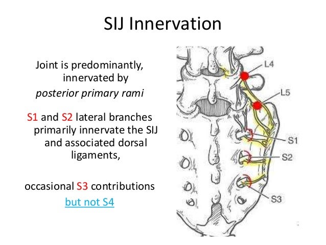 Sacroiliac Joint RF Denervation
