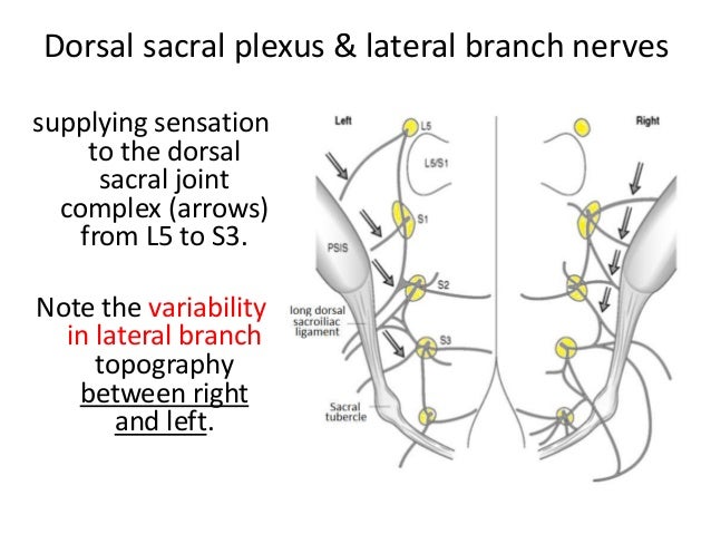 Sacroiliac Joint RF Denervation