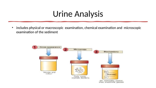 RFT.pptx Renal function tests are divided into the following Urine ...