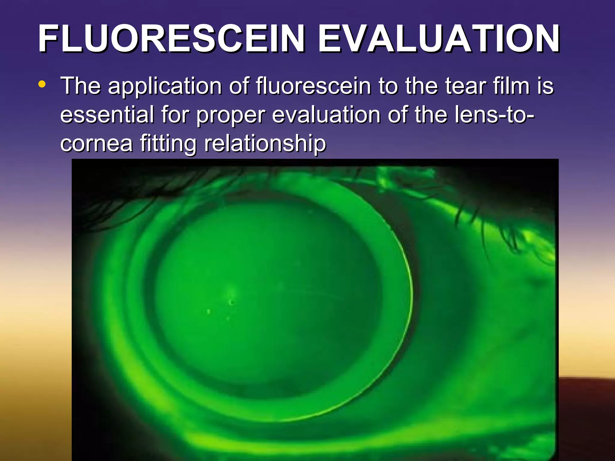 fitting RGP lenses | PPT