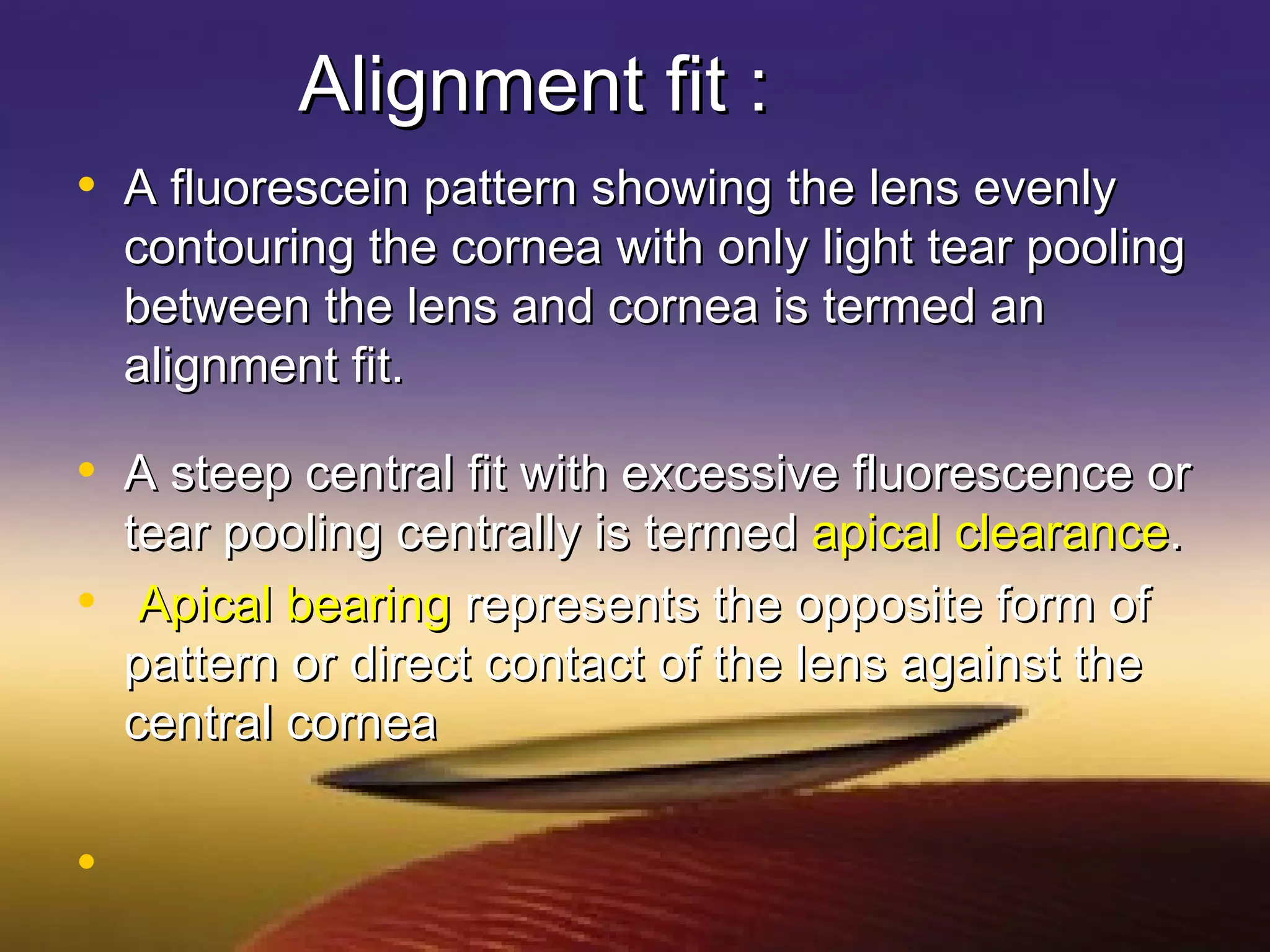 fitting RGP lenses | PPT