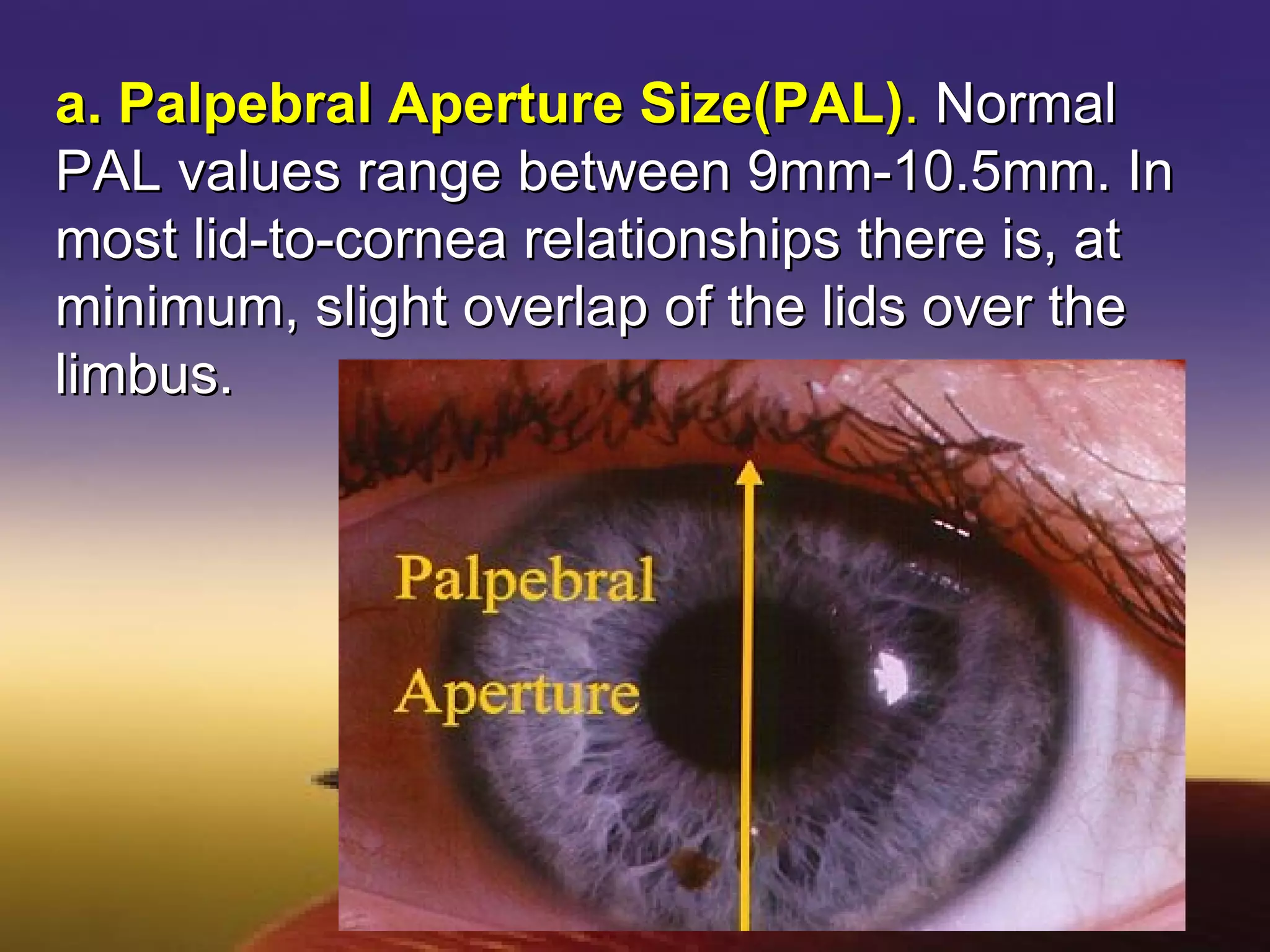 fitting RGP lenses | PPT