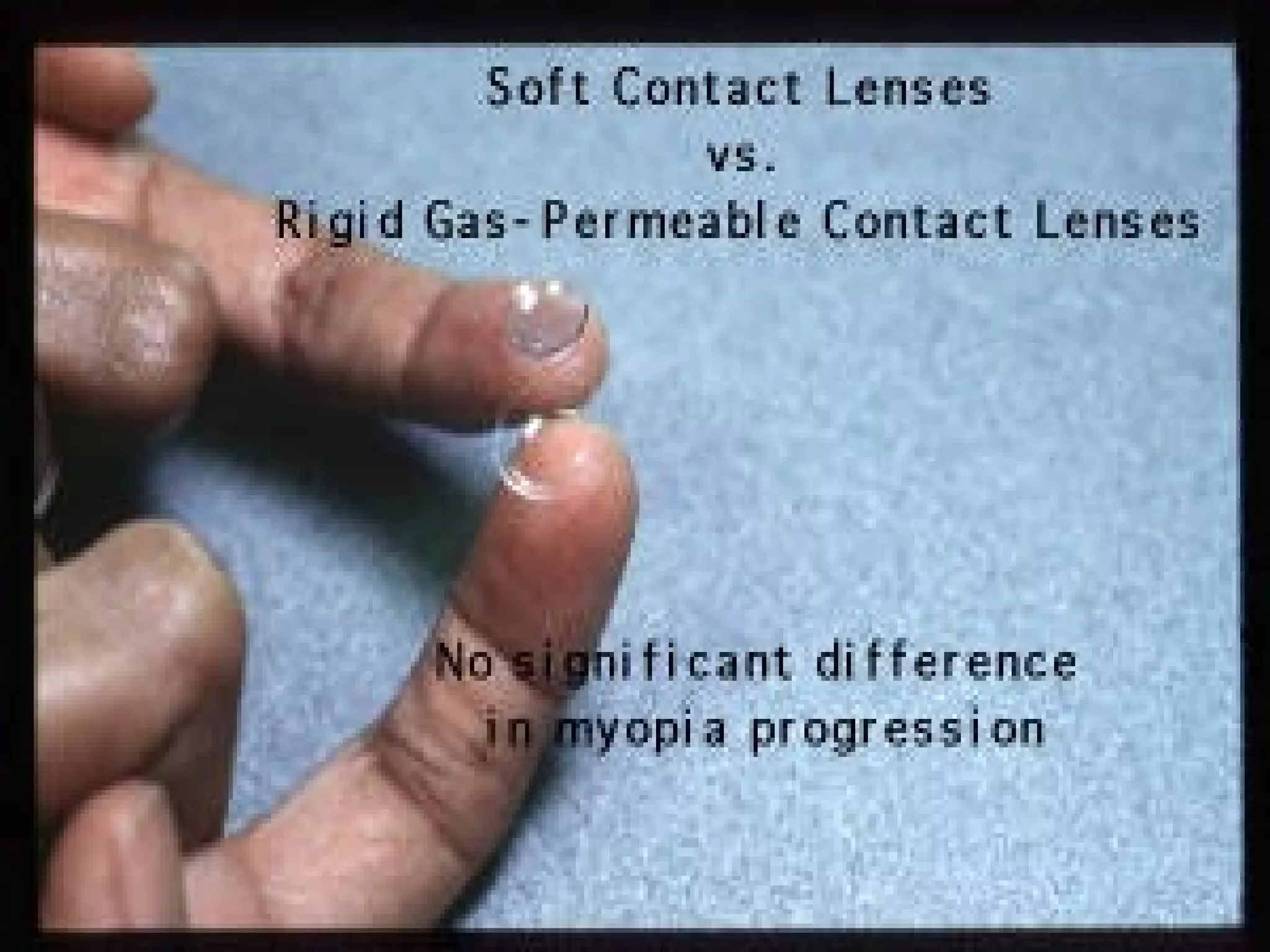 fitting RGP lenses | PPT