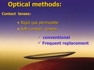 fitting RGP lenses | PPT