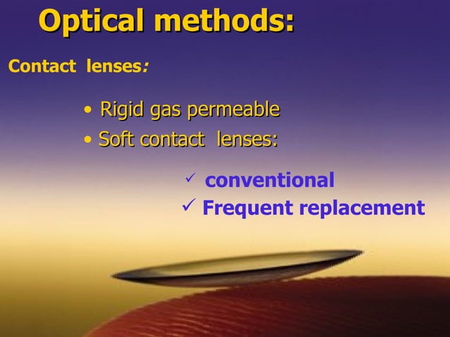 fitting RGP lenses | PPT