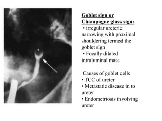 Retrograde Pyelography | PPTX