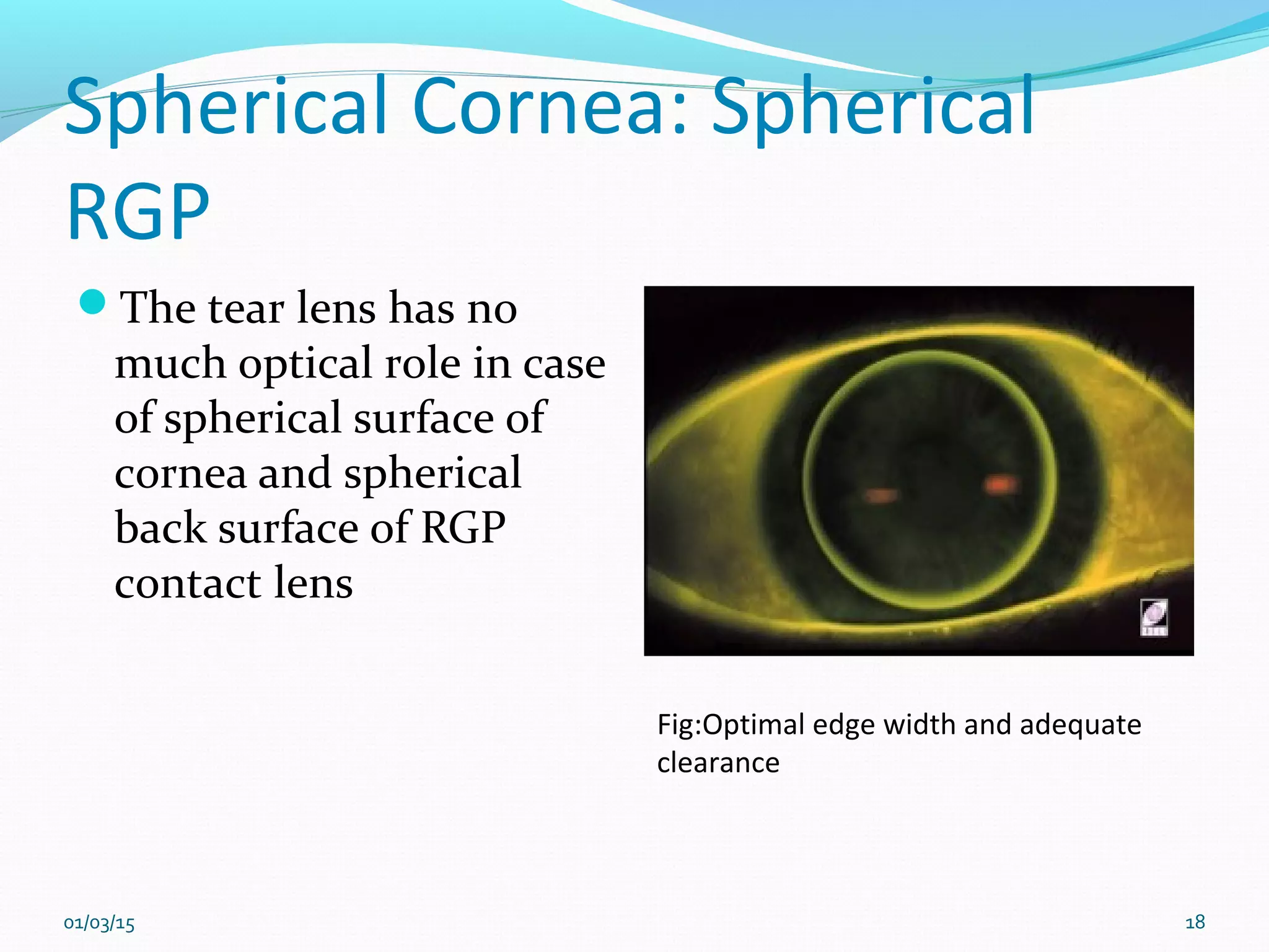 Optics of RGP contact lens | PPT