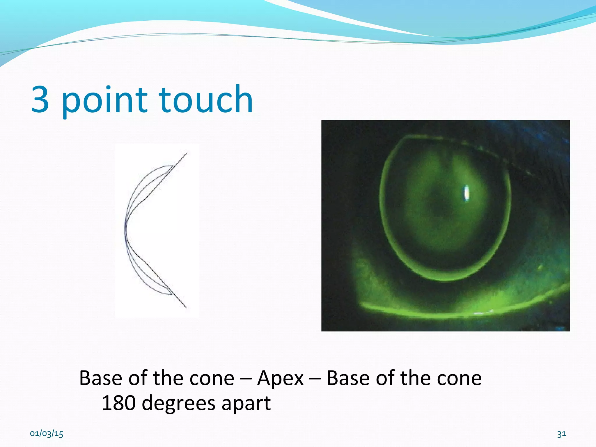 Optics of RGP contact lens | PPT