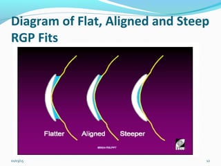 Optics of RGP contact lens | PPT