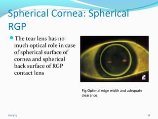 Optics of RGP contact lens | PPT