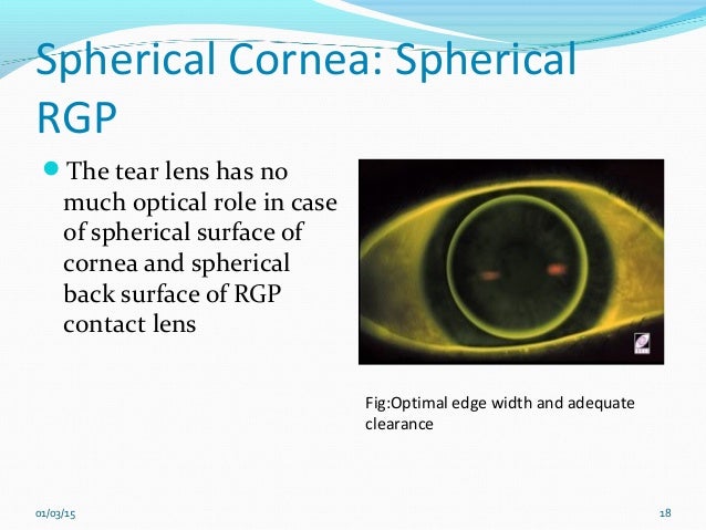 Optics of RGP contact lens