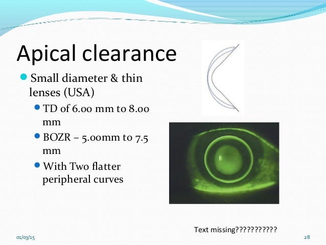Optics of RGP contact lens