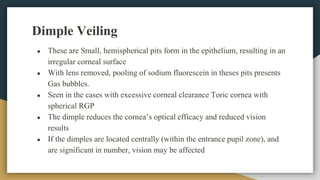 RGP Complications and Management.pptx