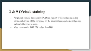 RGP Complications and Management.pptx