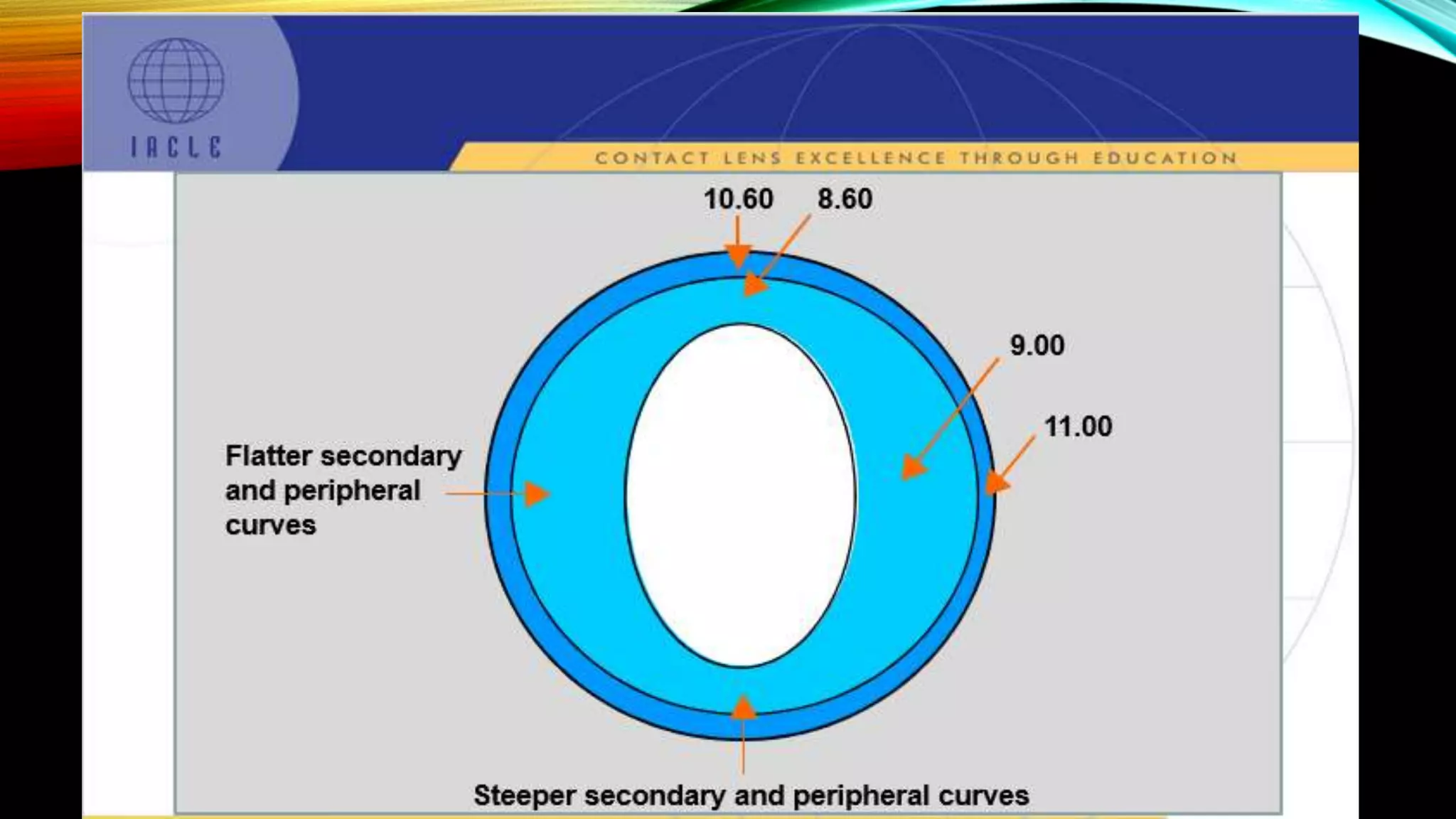 RGP Toric Contact lens | PPTX