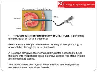 Rg stone hospital # 1 kidney hospital | PPT