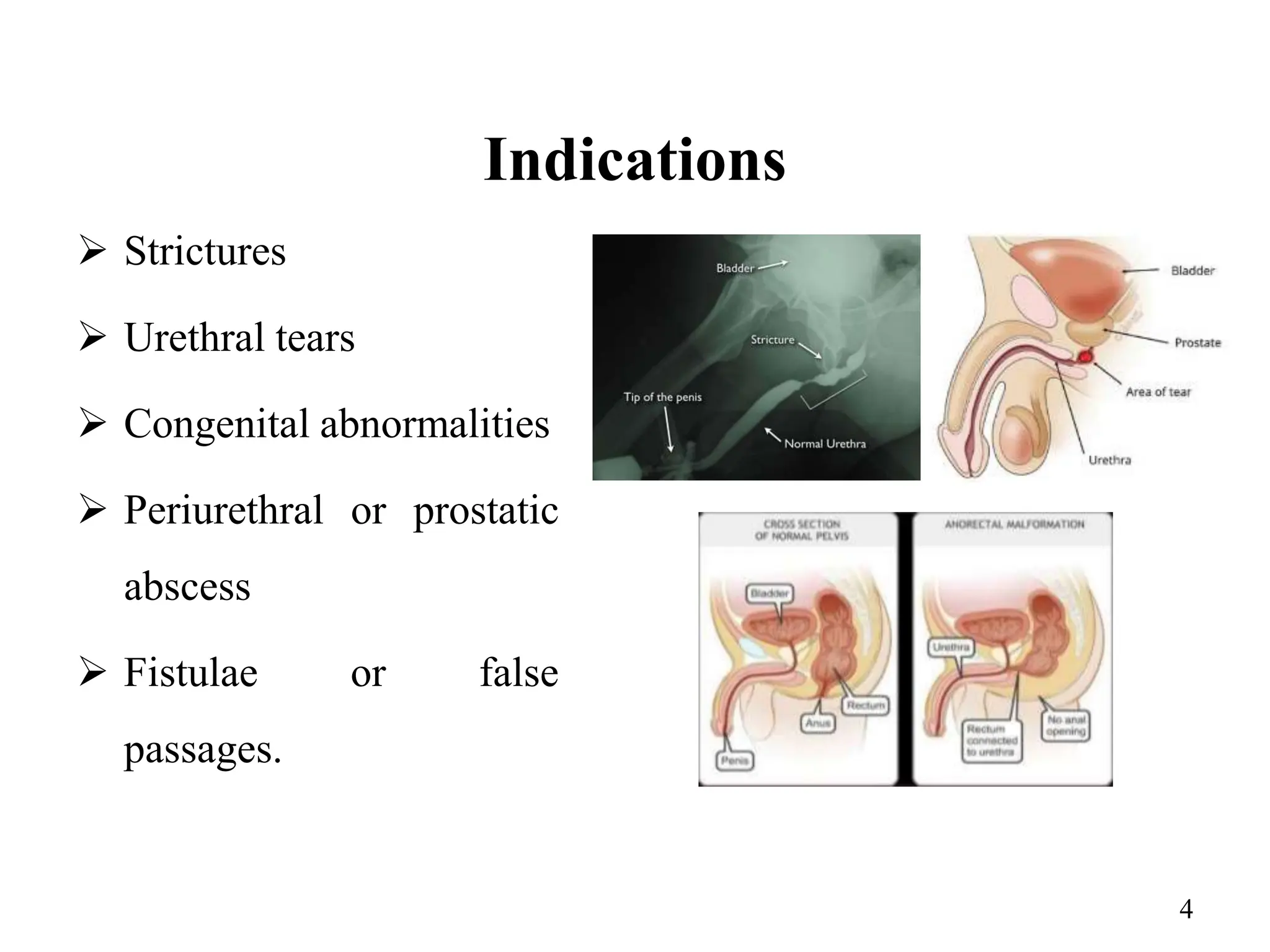 RGU.pptx this is ppt of RGU procedure film processing and positioning | PPT