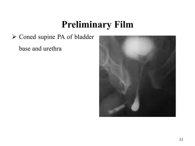 RGU.pptx this is ppt of RGU procedure film processing and positioning | PPT