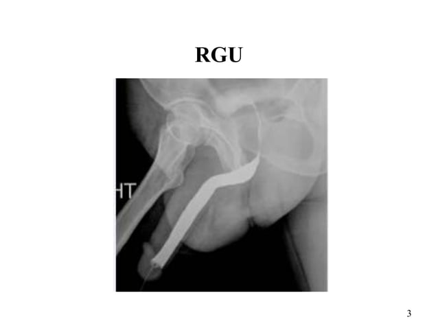 RGU.pptx this is ppt of RGU procedure film processing and positioning | PPT