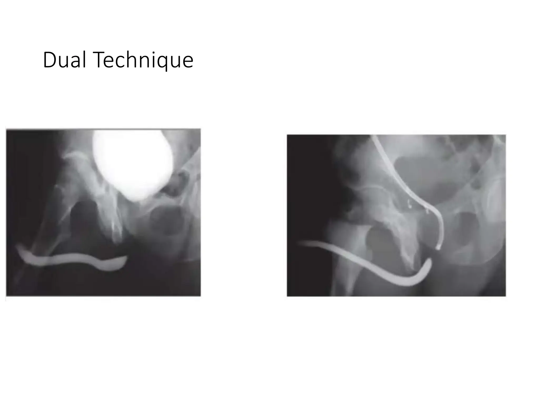 retrograde urethrogram for urology residents | PPTX