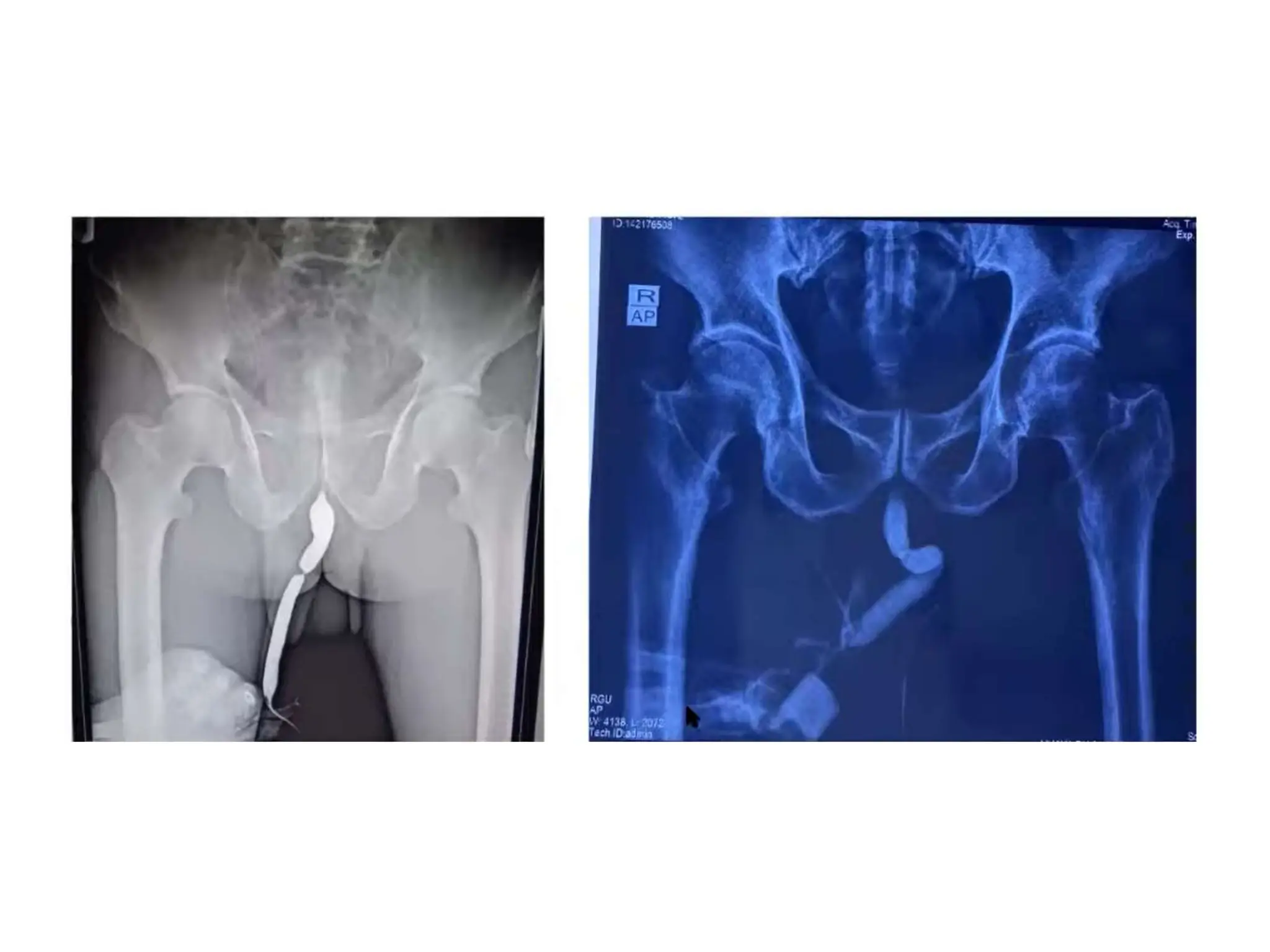 retrograde urethrogram for urology residents | PPTX