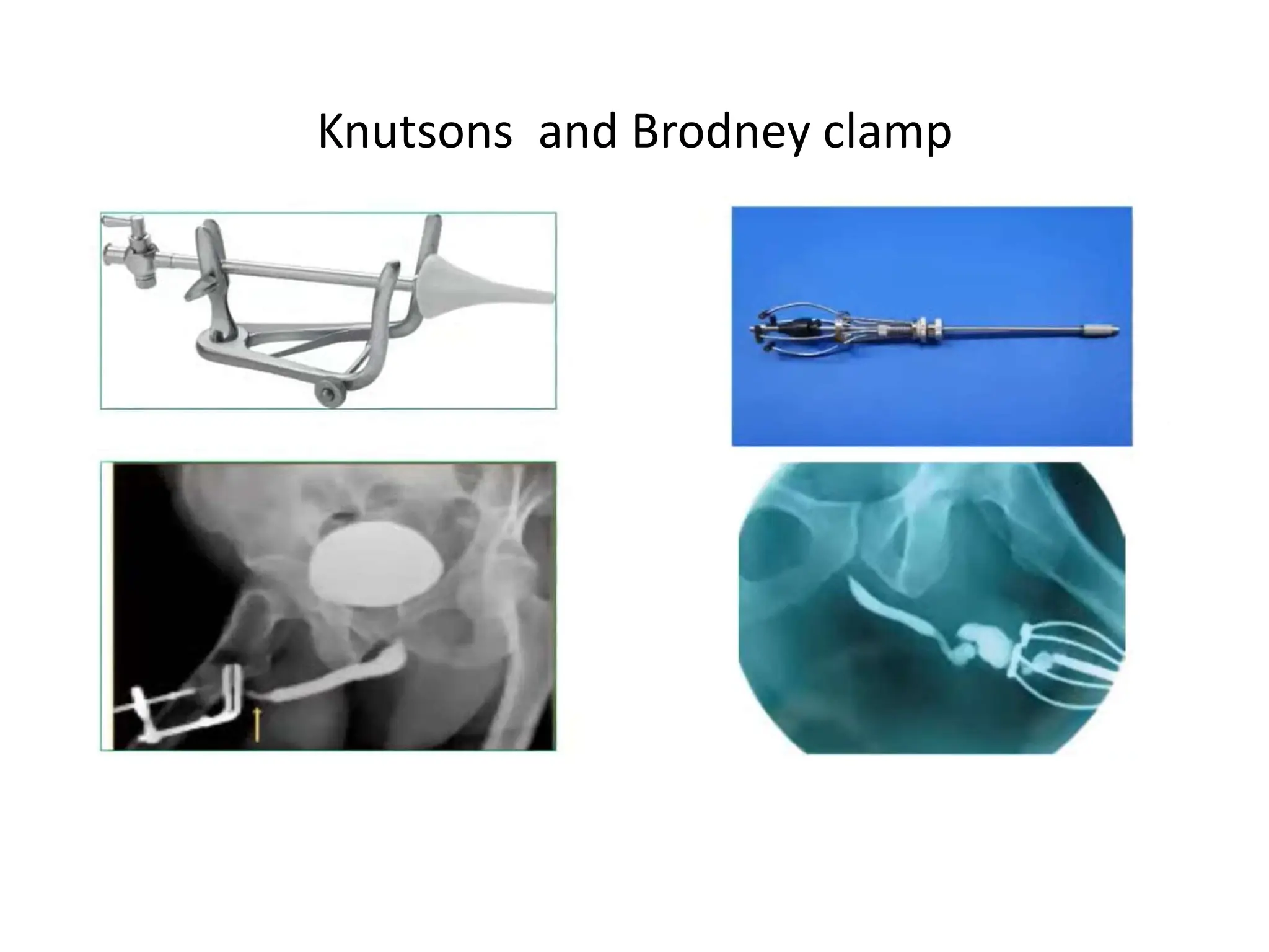 retrograde urethrogram for urology residents | PPTX