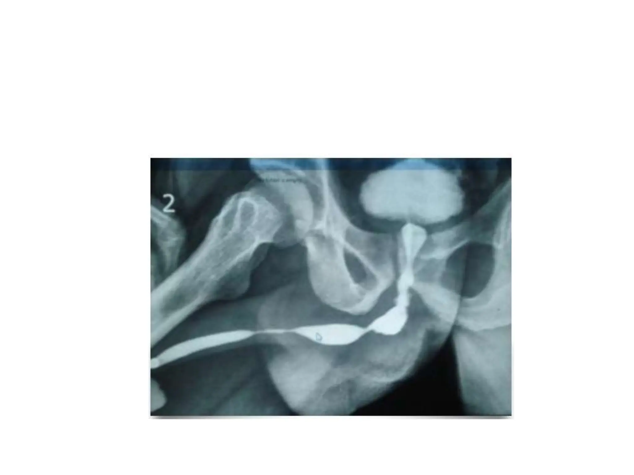 retrograde urethrogram for urology residents | PPTX