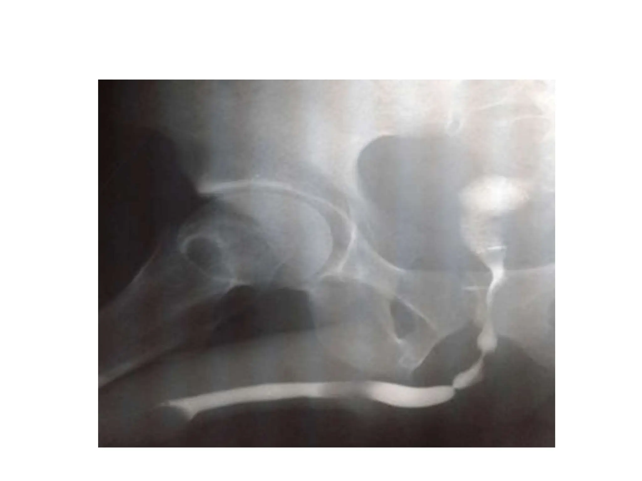 retrograde urethrogram for urology residents | PPTX