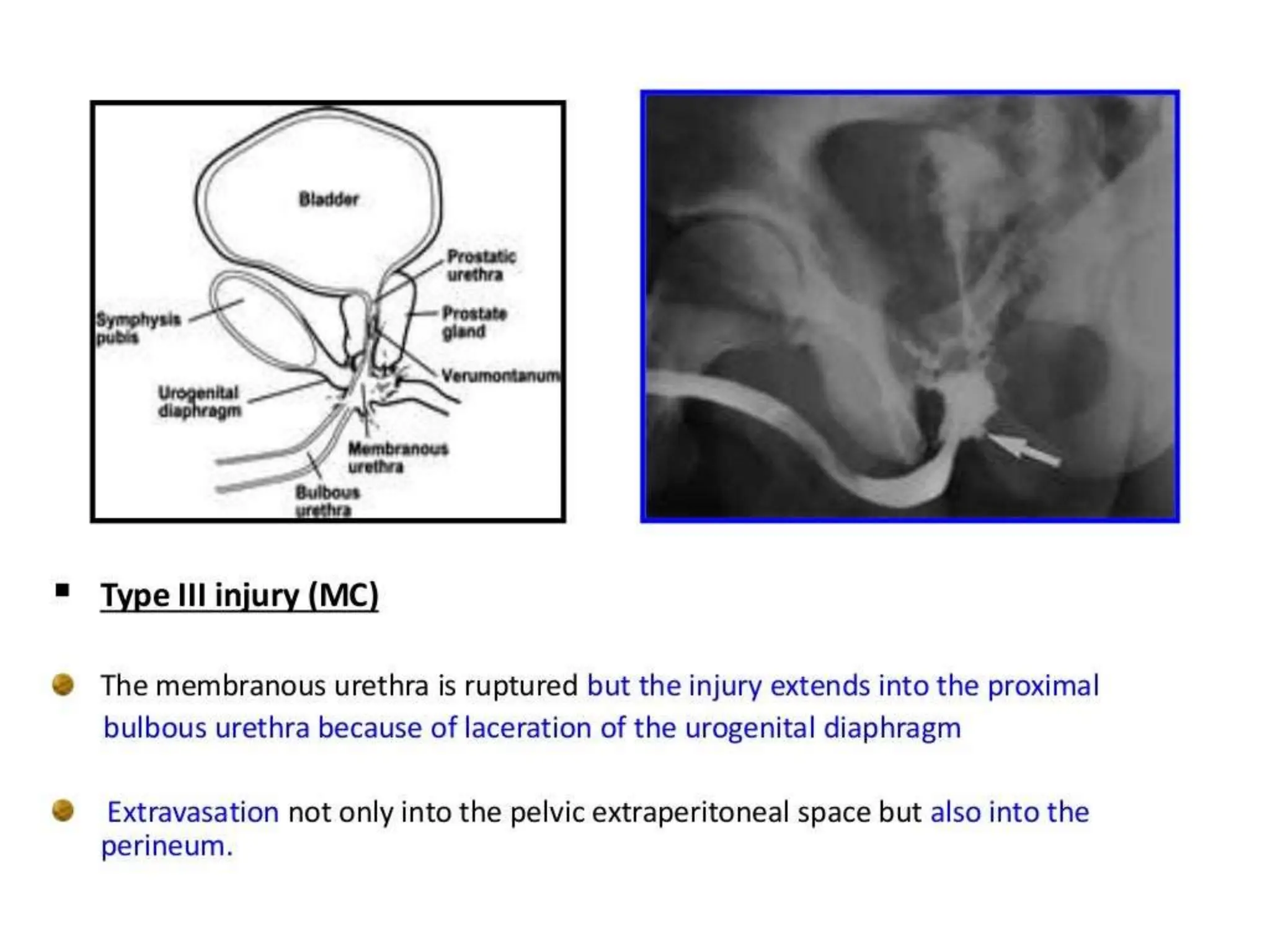 retrograde urethrogram for urology residents | PPTX