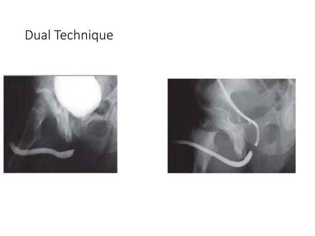 retrograde urethrogram for urology residents | PPTX