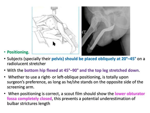 retrograde urethrogram for urology residents | PPTX