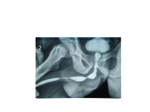 retrograde urethrogram for urology residents | PPTX