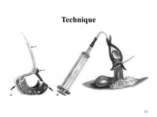 RGU1.pptx positioning of RGU and its procedure | PPTX