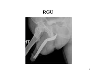 RGU1.pptx positioning of RGU and its procedure | PPTX