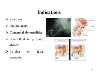 RGU1.pptx positioning of RGU and its procedure | PPTX