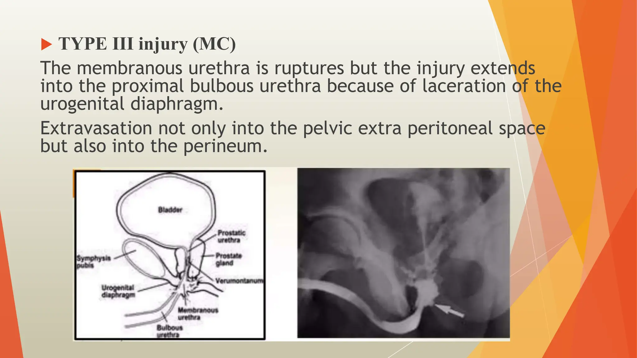 RGU and MCU – Procedure and interpretation in commonly encountered ...