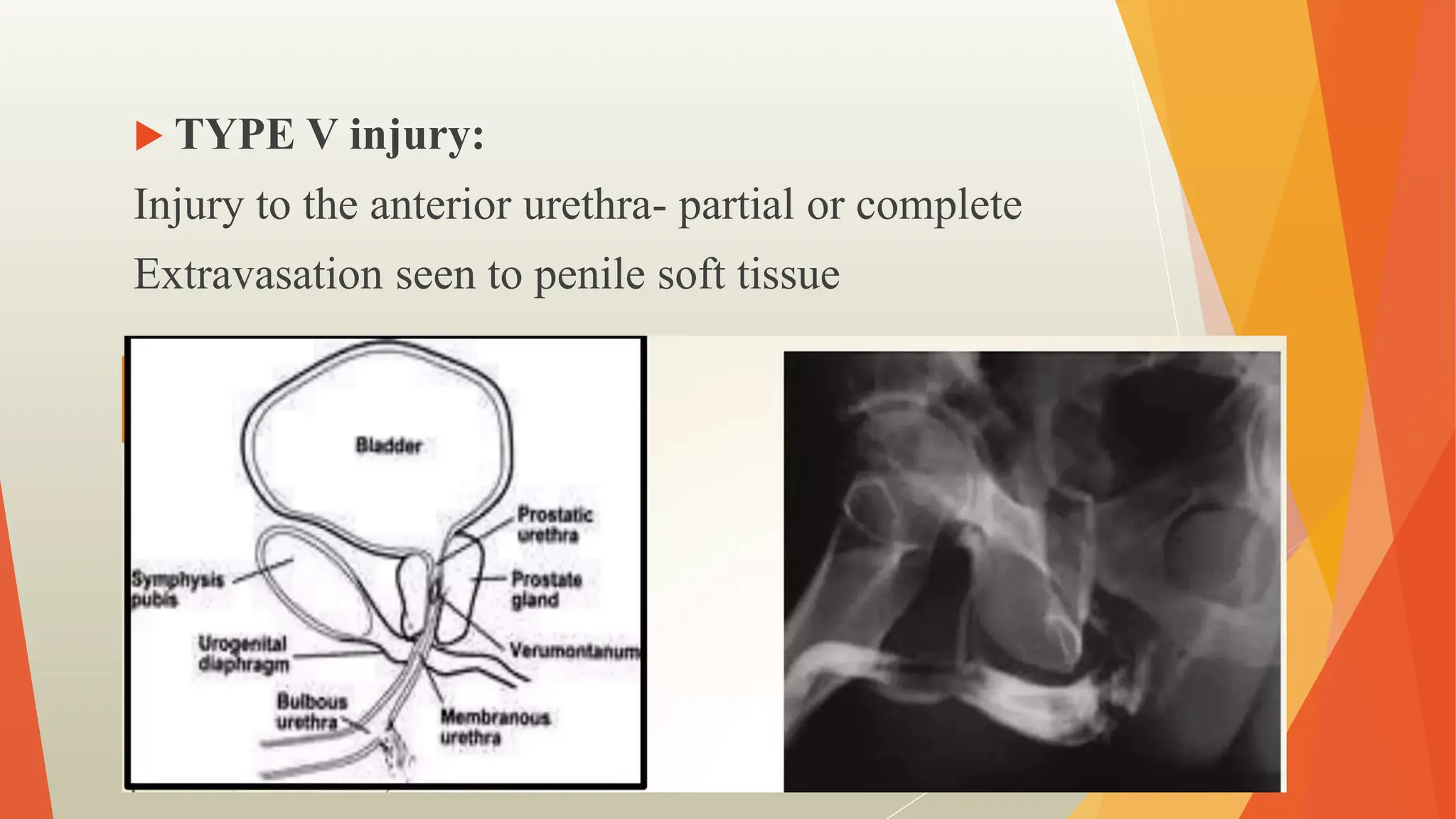 RGU and MCU – Procedure and interpretation in commonly encountered ...