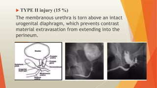 RGU and MCU – Procedure and interpretation in commonly encountered ...