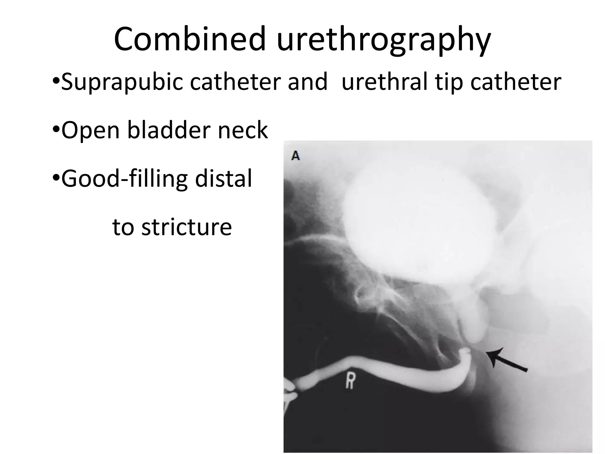RGU inter.pptx | Medical Tests | Medical Health
