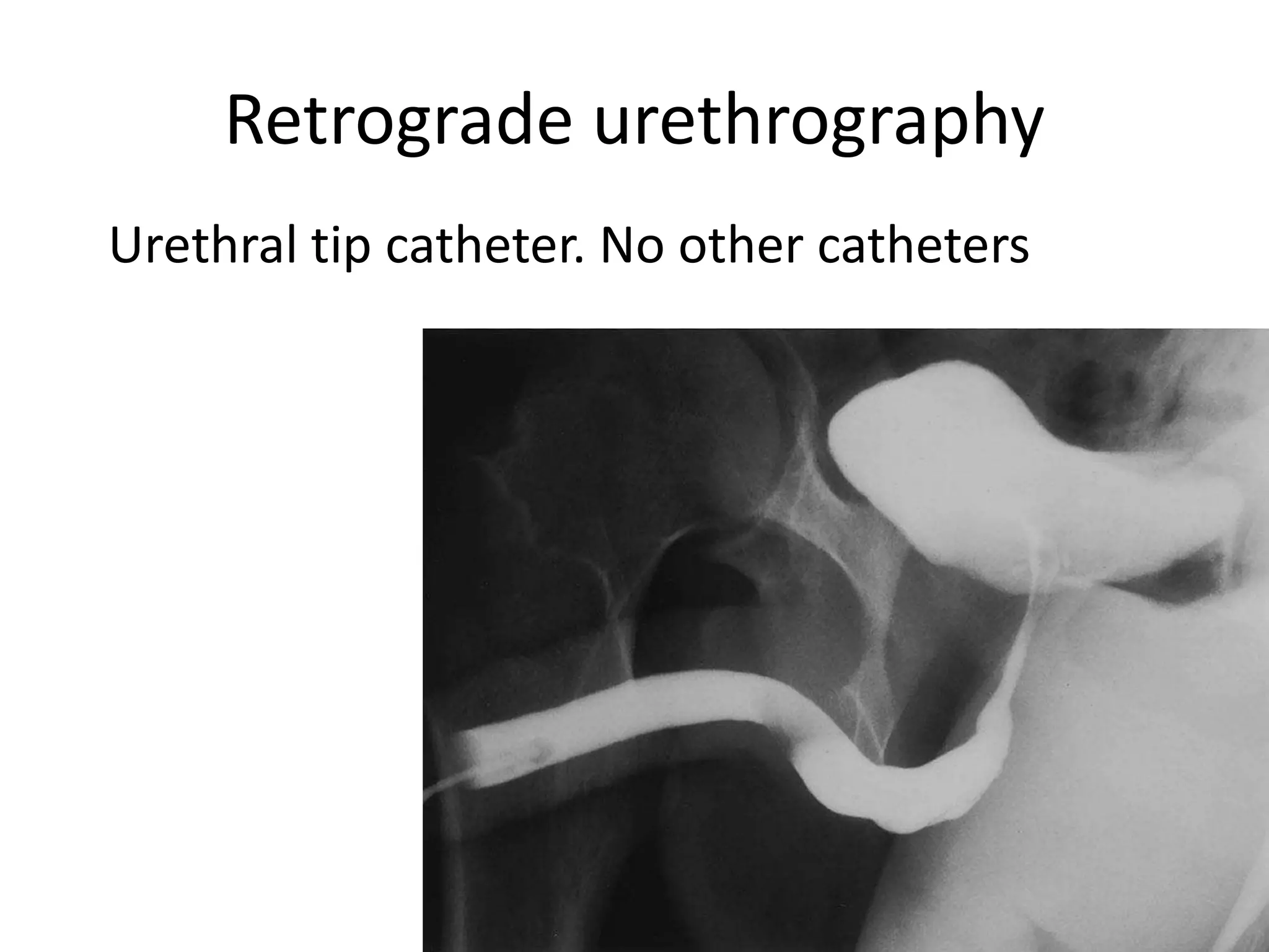 RGU inter.pptx | Medical Tests | Medical Health
