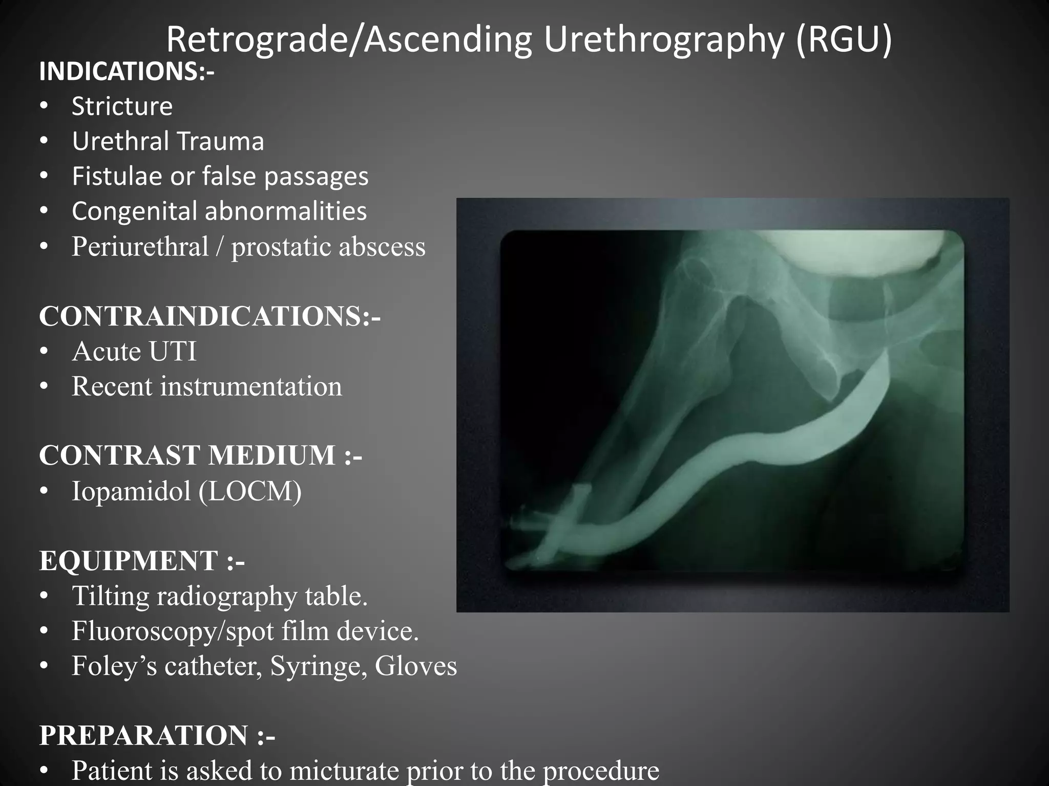 Anterograde/Retrograde urethrography (RGU/MCU) | PPTX