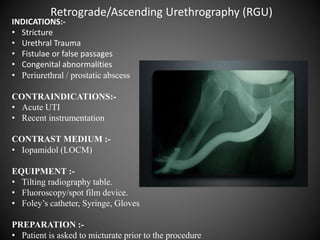 Anterograde/Retrograde urethrography (RGU/MCU) | PPTX