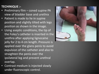 Anterograde/Retrograde urethrography (RGU/MCU) | PPTX