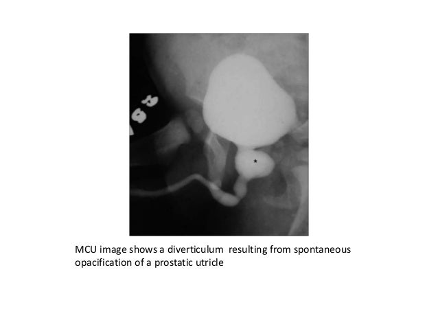 Rgu & mcu final presentation